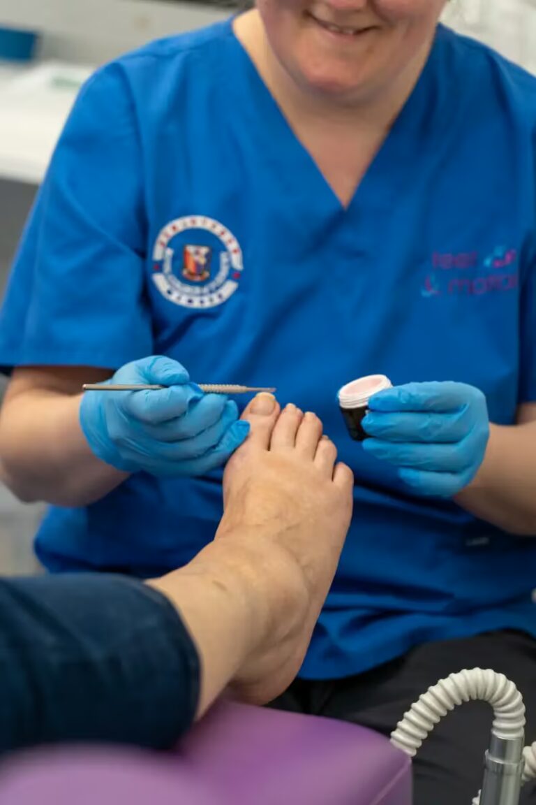 Nail Reconstruction In Horsham - Feet And Motion